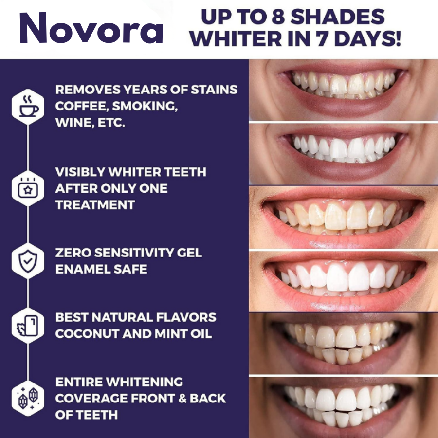 Novora Purple Teeth Whitening Strips™ – NOVORA